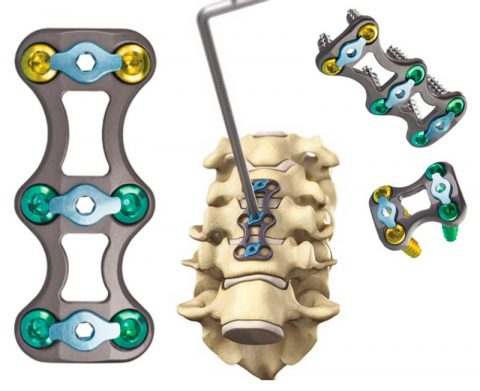 Columna Vertebral - Endo Médica Inversiones